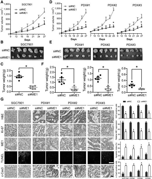 ME1 Regulates NADPH Homeostasis to Promote Gastric Cancer Growth and ...