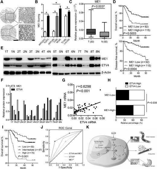 ME1 Regulates NADPH Homeostasis to Promote Gastric Cancer Growth and ...