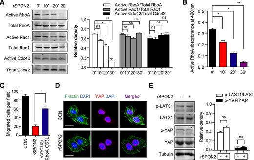 SPON2 Promotes M1-like Macrophage Recruitment and Inhibits ...