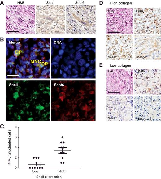 A Soft Microenvironment Protects from Failure of Midbody Abscission and ...