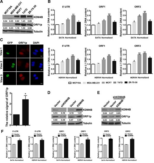 Histone Demethylase KDM4B Promotes DNA Damage by Activating Long ...