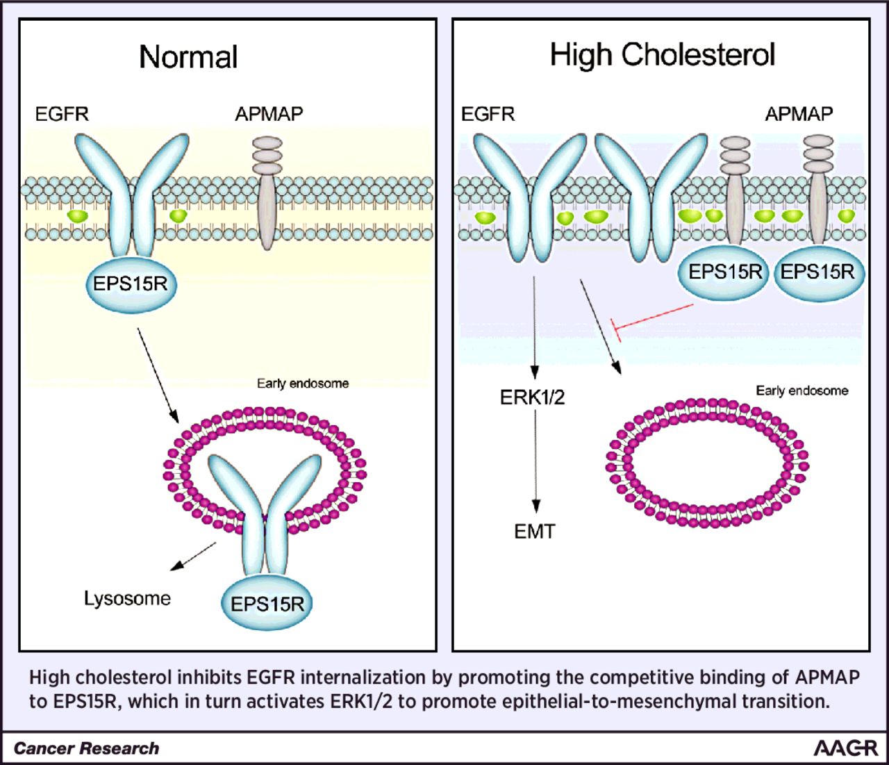 Cholesterol Induces Epithelial-to-Mesenchymal Transition of Prostate ...
