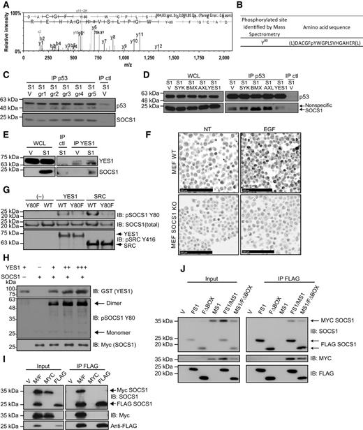 Phosphorylation of SOCS1 Inhibits the SOCS1–p53 Tumor Suppressor Axis ...