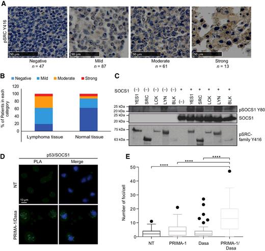 Phosphorylation of SOCS1 Inhibits the SOCS1–p53 Tumor Suppressor Axis ...