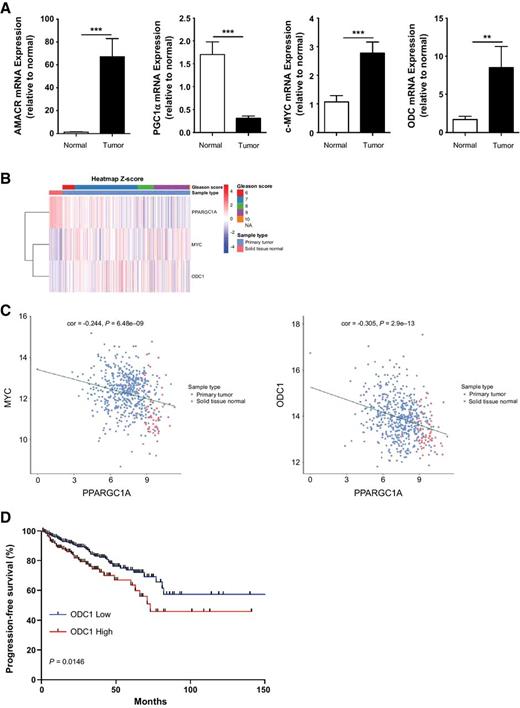 PGC1α Inhibits Polyamine Synthesis to Suppress Prostate Cancer ...