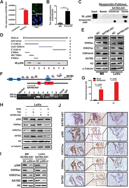 SATB2-AS1 Suppresses Colorectal Carcinoma Aggressiveness by Inhibiting ...