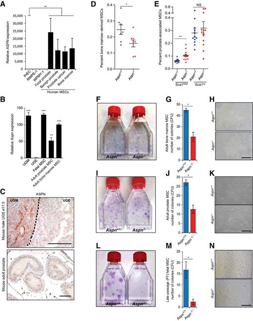 Asporin Restricts Mesenchymal Stromal Cell Differentiation, Alters the ...