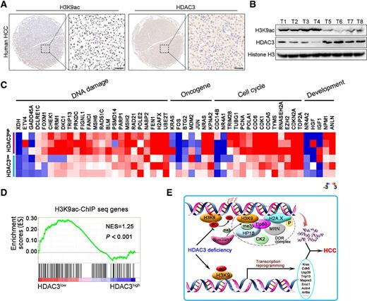 HDAC3 Deficiency Promotes Liver Cancer through a Defect in H3K9ac ...