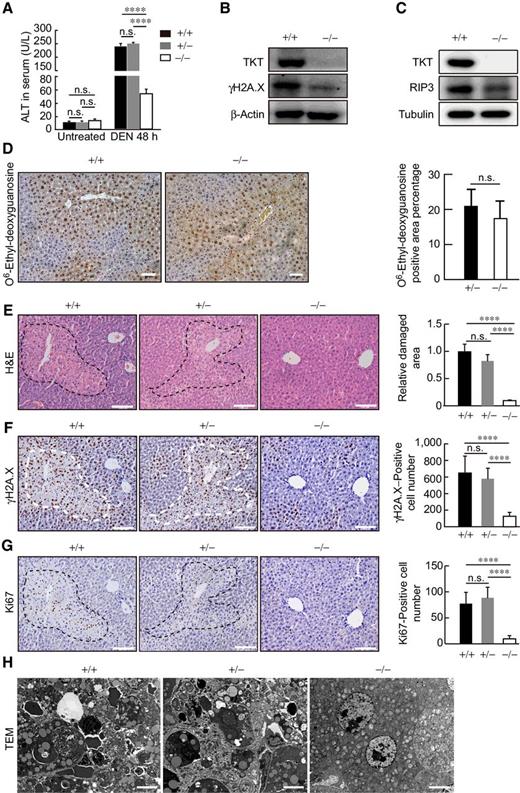 Transketolase Deficiency Protects the Liver from DNA Damage by ...