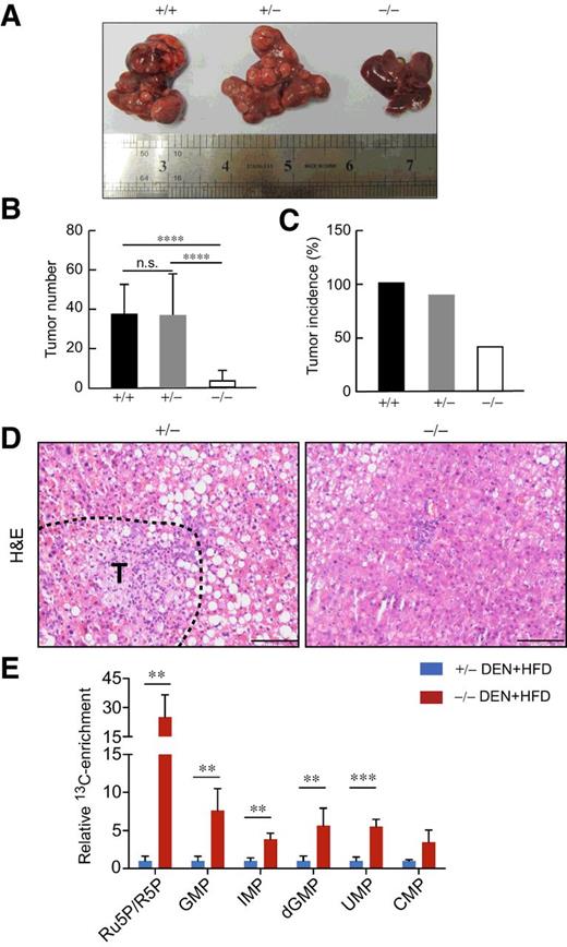 Transketolase Deficiency Protects the Liver from DNA Damage by ...