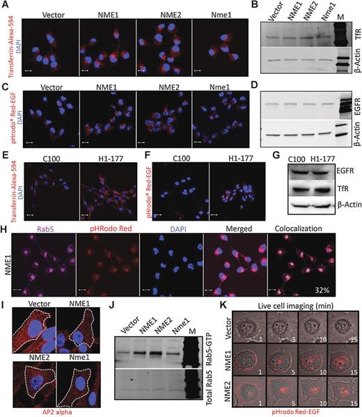 Metastasis Suppressors NME1 and NME2 Promote Dynamin 2 Oligomerization ...