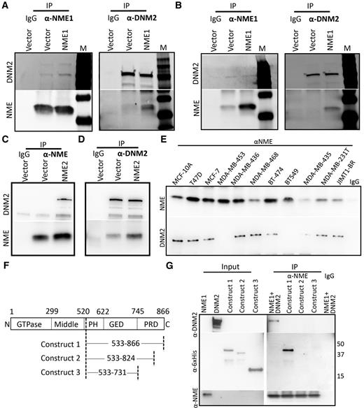 Metastasis Suppressors NME1 and NME2 Promote Dynamin 2 Oligomerization ...