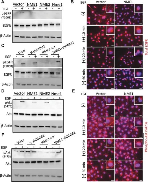 Metastasis Suppressors NME1 and NME2 Promote Dynamin 2 Oligomerization ...