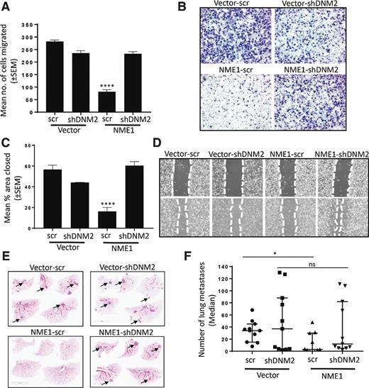 Metastasis Suppressors NME1 and NME2 Promote Dynamin 2 Oligomerization ...