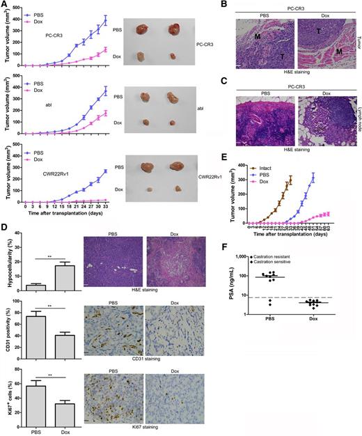 Glutamate Decarboxylase 65 Signals through the Androgen Receptor to ...