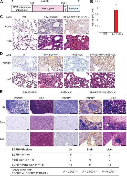 MAP4K3/GLK Promotes Lung Cancer Metastasis by Phosphorylating and ...