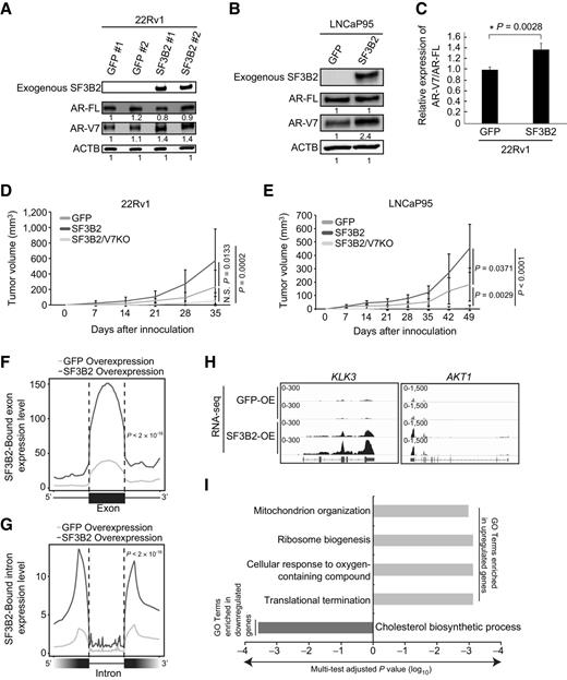 SF3B2-Mediated RNA Splicing Drives Human Prostate Cancer Progression ...