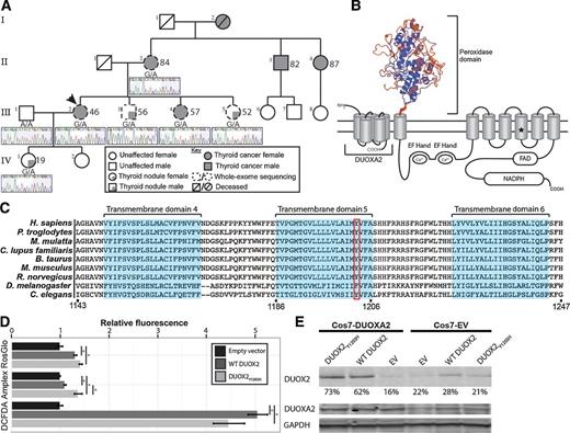 Genetic Variants Implicate Dual Oxidase-2 in Familial and Sporadic ...