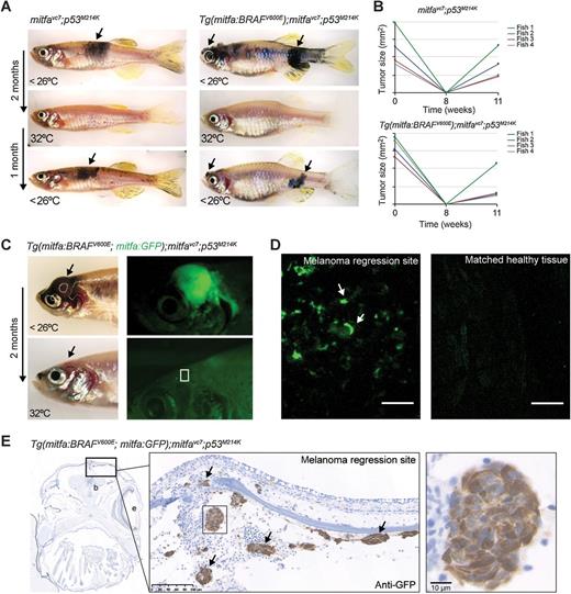 Zebrafish MITF-Low Melanoma Subtype Models Reveal Transcriptional ...
