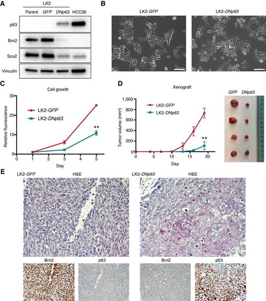 Epigenomic Profiling Discovers Trans-lineage SOX2 Partnerships Driving ...