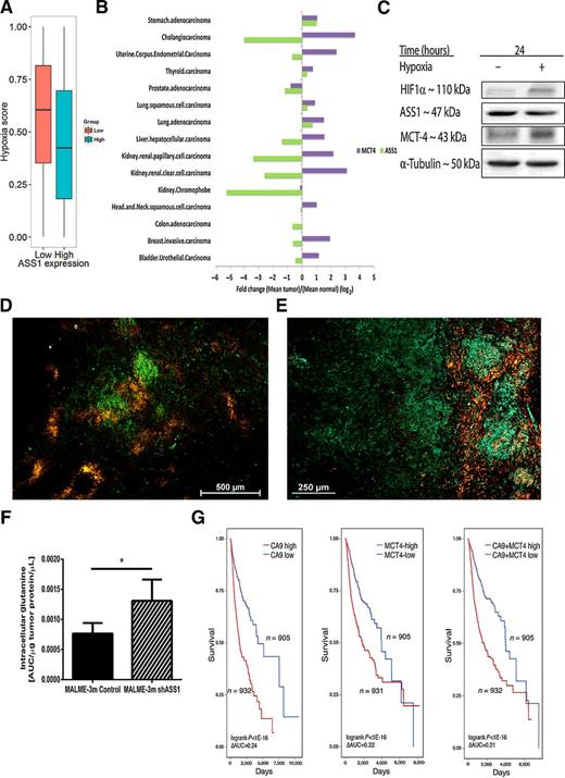 Acid-Induced Downregulation of ASS1 Contributes to the Maintenance of ...