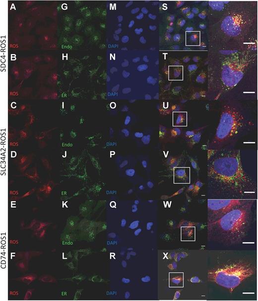 Differential Subcellular Localization Regulates Oncogenic Signaling by ...