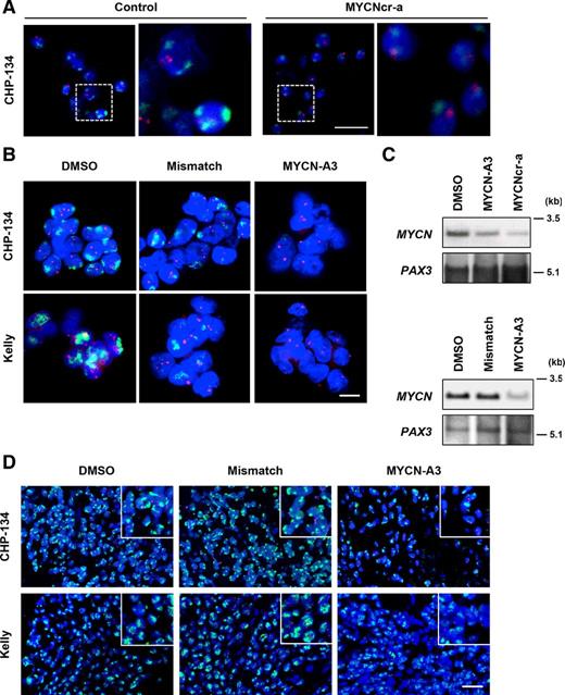 Direct Targeting of MYCN Gene Amplification by Site-Specific DNA ...