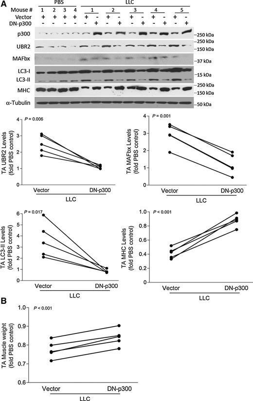 p300 Mediates Muscle Wasting in Lewis Lung Carcinoma | Cancer Research ...