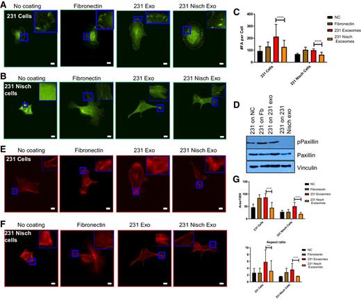 Exosomes from Nischarin-Expressing Cells Reduce Breast Cancer Cell ...