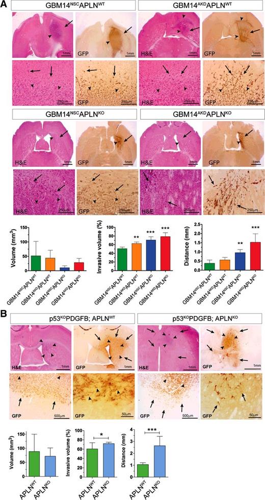 Targeting APLN/APLNR Improves Antiangiogenic Efficiency and Blunts ...