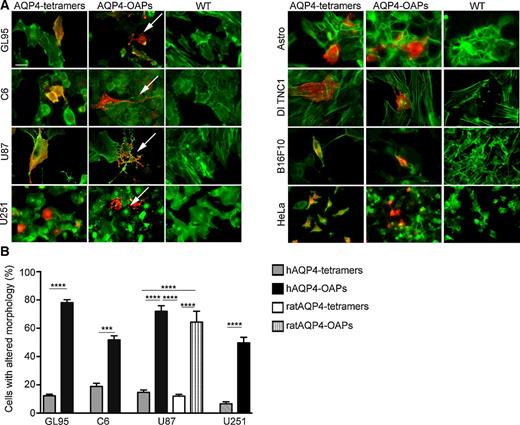 AQP4 Aggregation State Is a Determinant for Glioma Cell Fate | Cancer ...