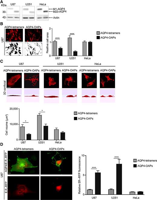 AQP4 Aggregation State Is a Determinant for Glioma Cell Fate | Cancer ...