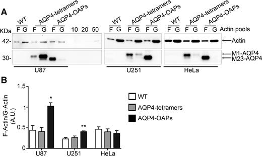 AQP4 Aggregation State Is a Determinant for Glioma Cell Fate | Cancer ...