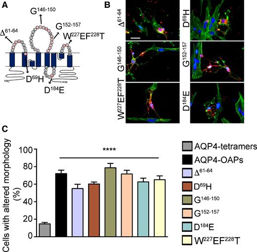 AQP4 Aggregation State Is a Determinant for Glioma Cell Fate | Cancer ...