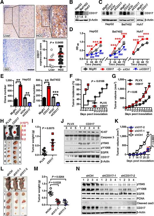 CD317 Activates EGFR by Regulating Its Association with Lipid Rafts ...