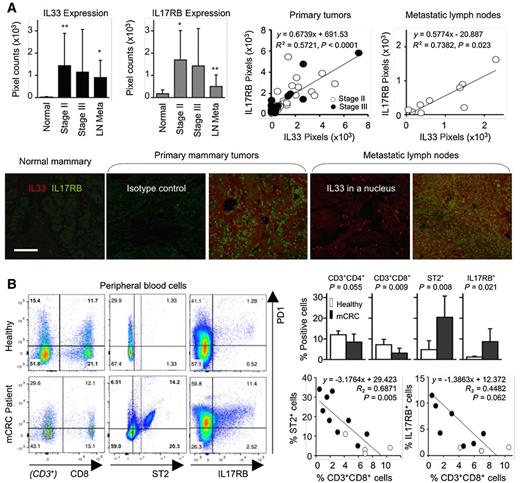 IL33 Is a Key Driver of Treatment Resistance of Cancer | Cancer ...