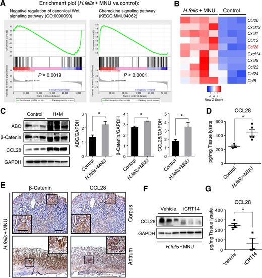 Blockade of β-Catenin–Induced CCL28 Suppresses Gastric Cancer ...