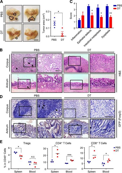 Blockade of β-Catenin–Induced CCL28 Suppresses Gastric Cancer ...