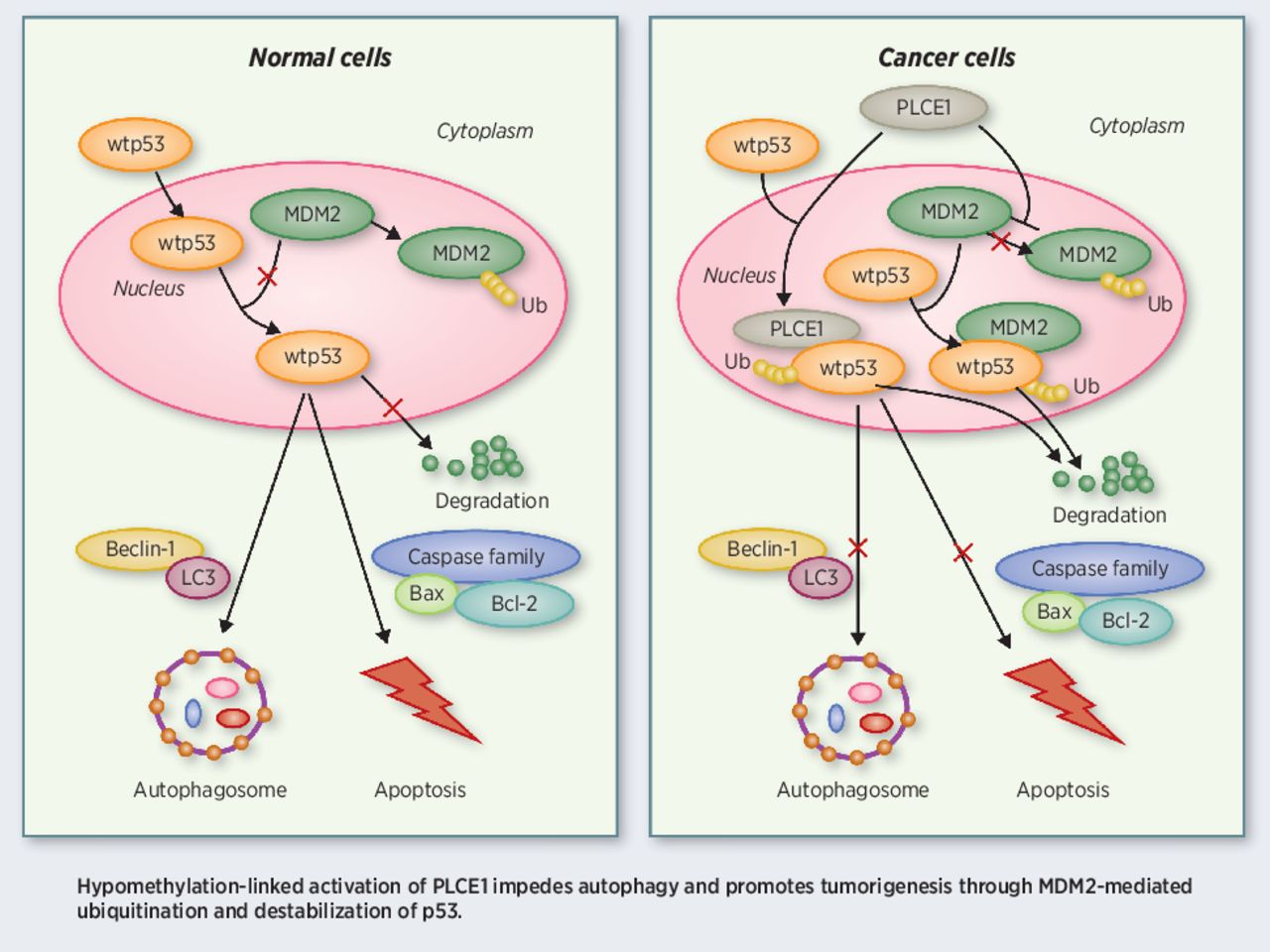 Hypomethylation-Linked Activation of PLCE1 Impedes Autophagy and ...