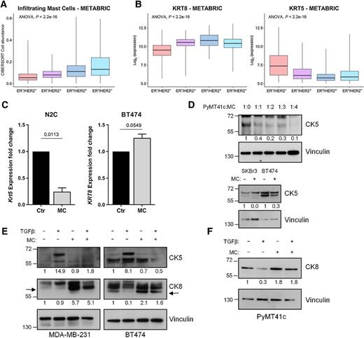 Infiltrating Mast Cell–Mediated Stimulation of Estrogen Receptor ...