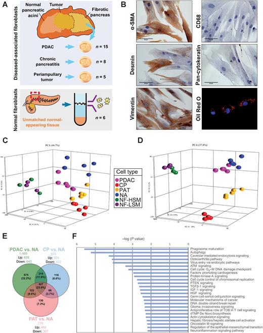Fibroblasts from Distinct Pancreatic Pathologies Exhibit Disease ...
