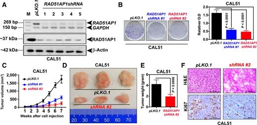 RAD51AP1 Deficiency Reduces Tumor Growth by Targeting Stem Cell Self ...
