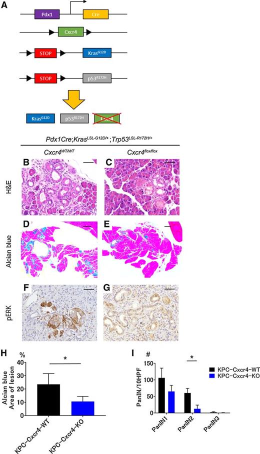 CXCR4 in Tumor Epithelial Cells Mediates Desmoplastic Reaction in ...