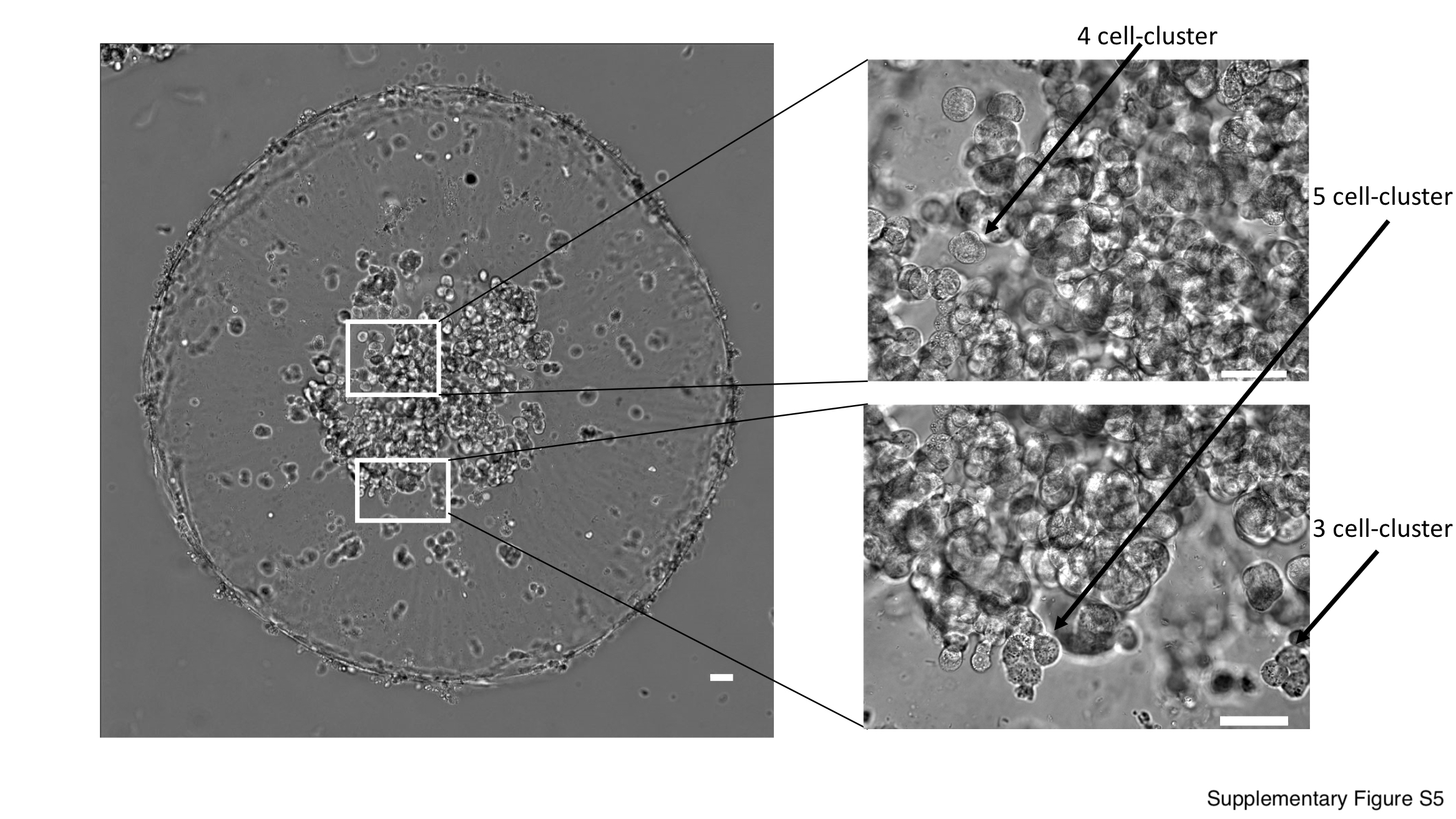 An Engineered Tumor-on-a-Chip Device with Breast Cancer–Immune Cell ...