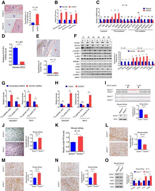 Inactivation of the AMPK–GATA3–ECHS1 Pathway Induces Fatty Acid ...