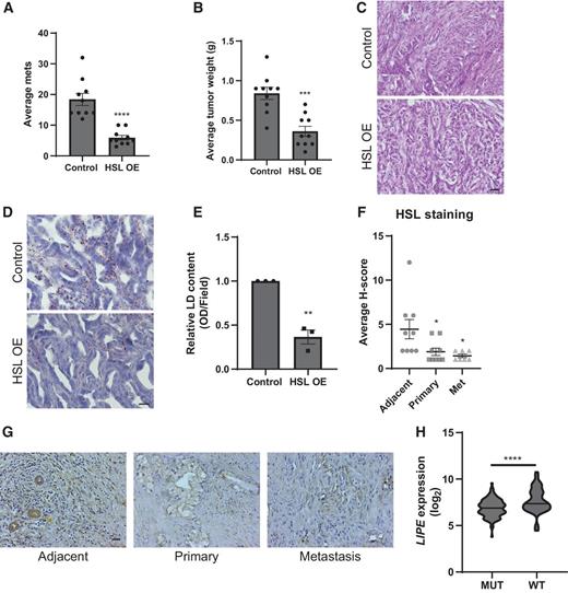 KRAS Controls Pancreatic Cancer Cell Lipid Metabolism and Invasive ...