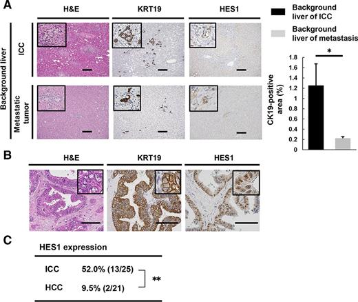 Hes1 Is Essential in Proliferating Ductal Cell–Mediated Development of ...