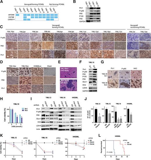 A Hyperactive RelA/p65-Hexokinase 2 Signaling Axis Drives Primary ...