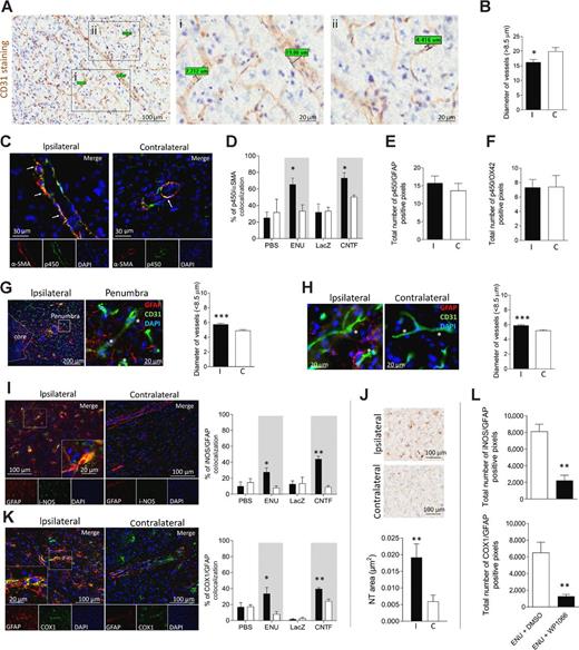 STAT3-Mediated Astrocyte Reactivity Associated with Brain Metastasis ...