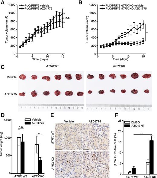 Genome-Wide CRISPR-Cas9 Screen Reveals Selective Vulnerability of ATRX ...